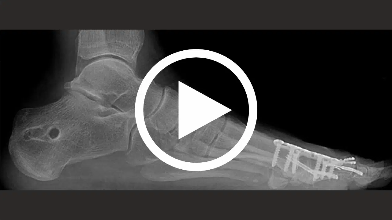 Video Library - COREX