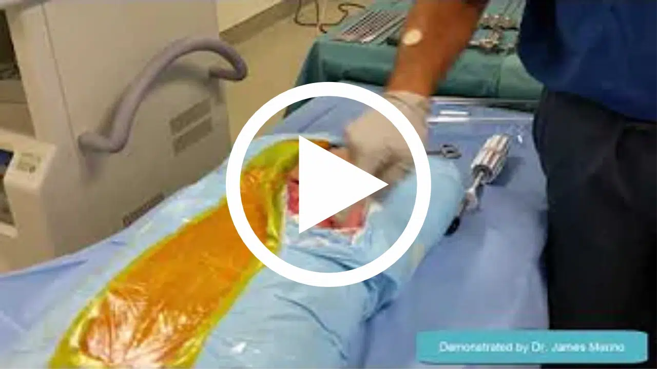 Video Library - COREX