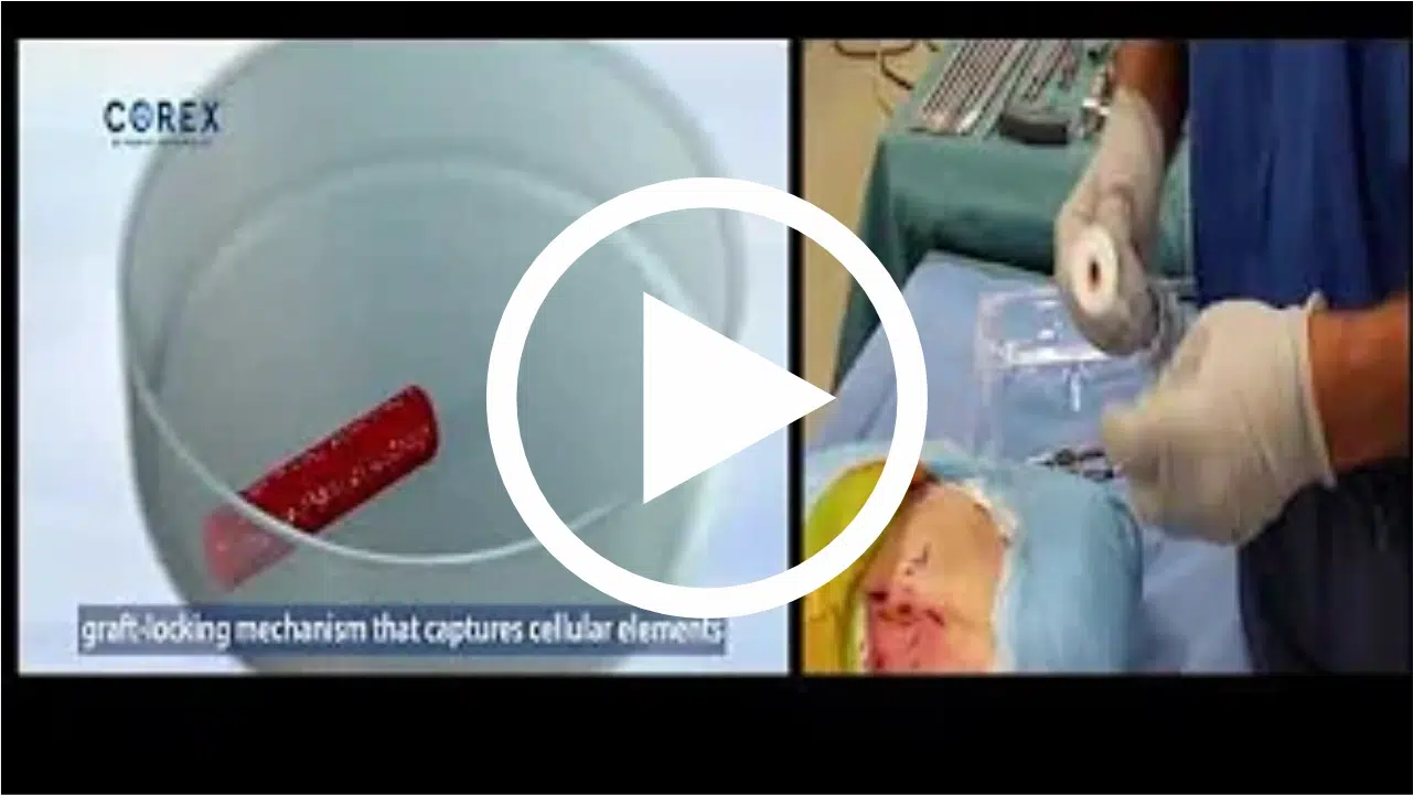 Video Library - COREX