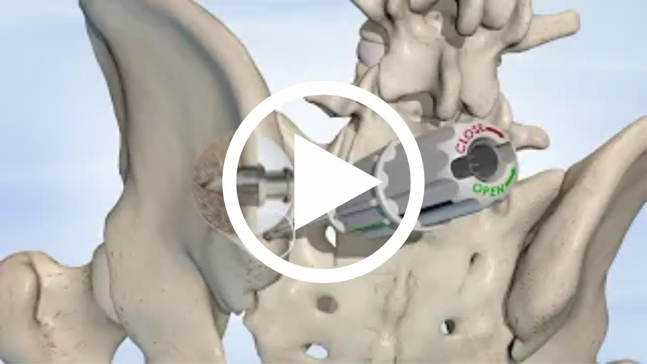 Video Library - COREX