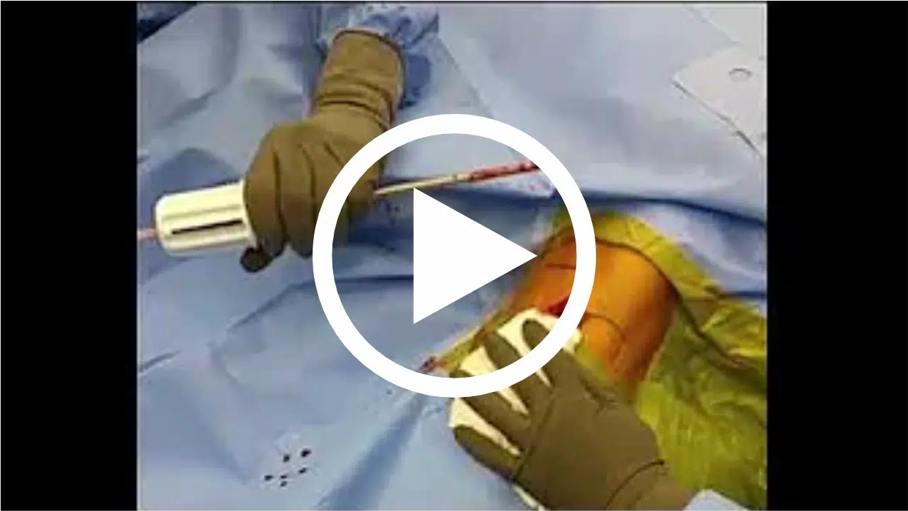 Video Library - COREX