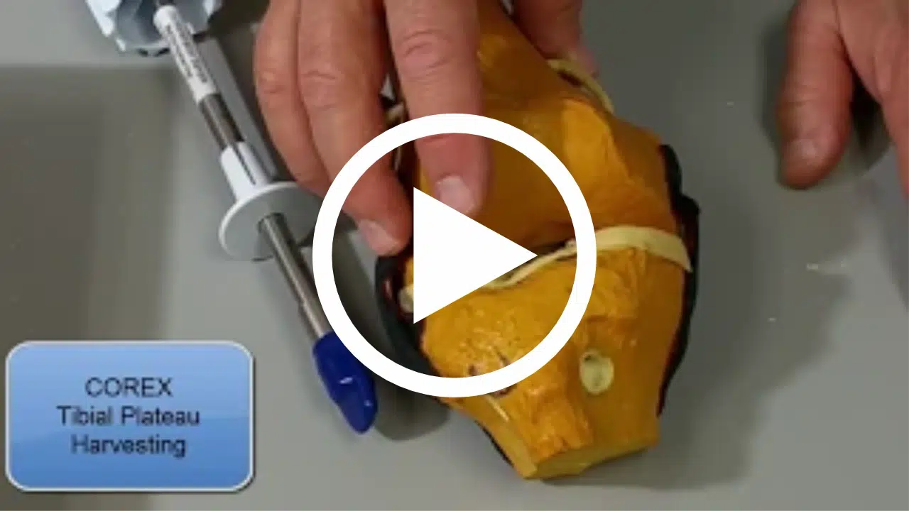 Video Library - COREX