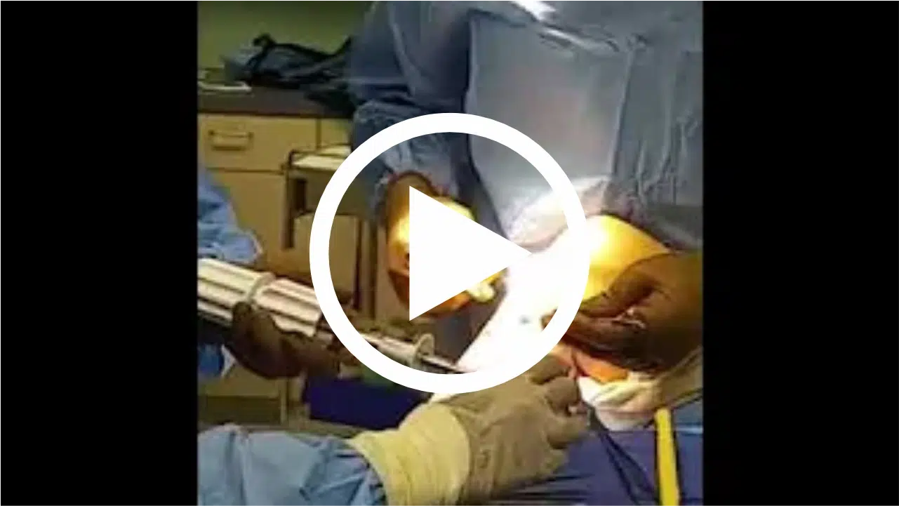 Video Library - COREX