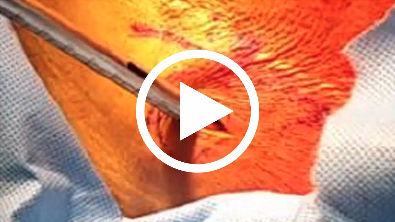 Video Library - COREX